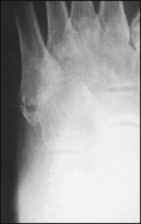 Foot Musculoskeletal Key