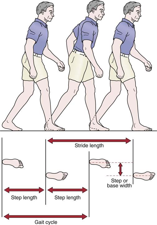 Assessment Of Gait Musculoskeletal Key Assessment Of Gait Musculoskeletal Key