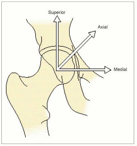 Features Of Osteoarthritis At Specific Sites Musculoskeletal Key Features Of Osteoarthritis At Specific Sites Musculoskeletal Key