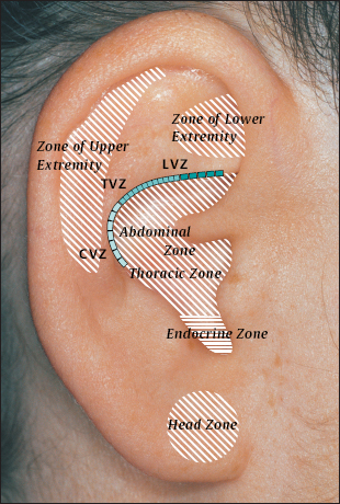 Basic Principles of Auricular Acupuncture | Musculoskeletal Key