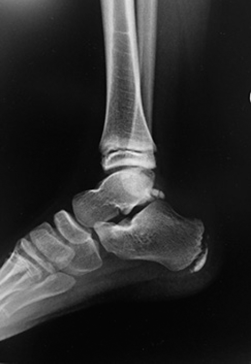 Foot Musculoskeletal Key