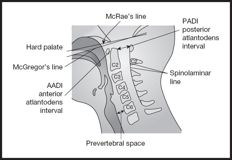 NECK | Musculoskeletal Key