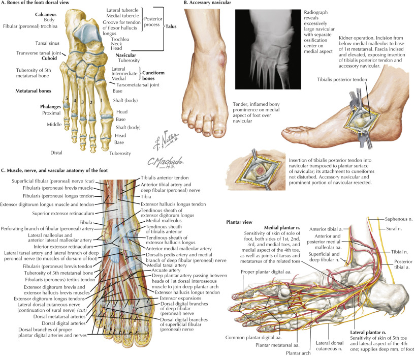 Foot Problems Musculoskeletal Key
