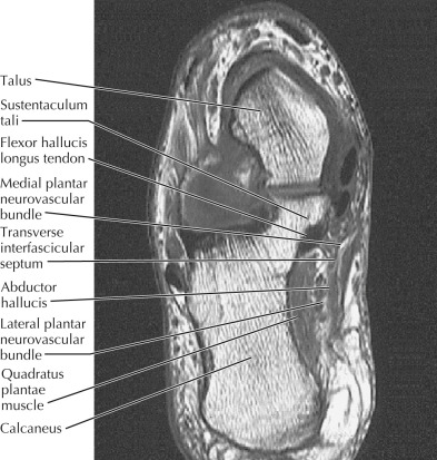 Foot Problems Musculoskeletal Key