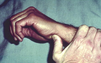 gr3.jpg | Musculoskeletal Key