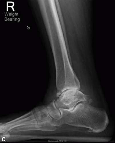 Foot And Ankle Musculoskeletal Key