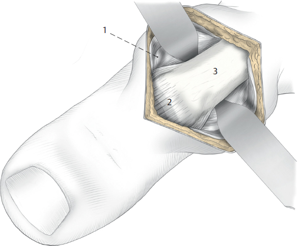 13 Foot Musculoskeletal Key