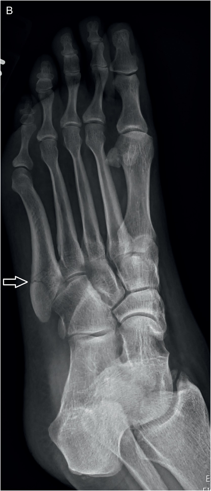 Chapter 8 – Foot | Musculoskeletal Key